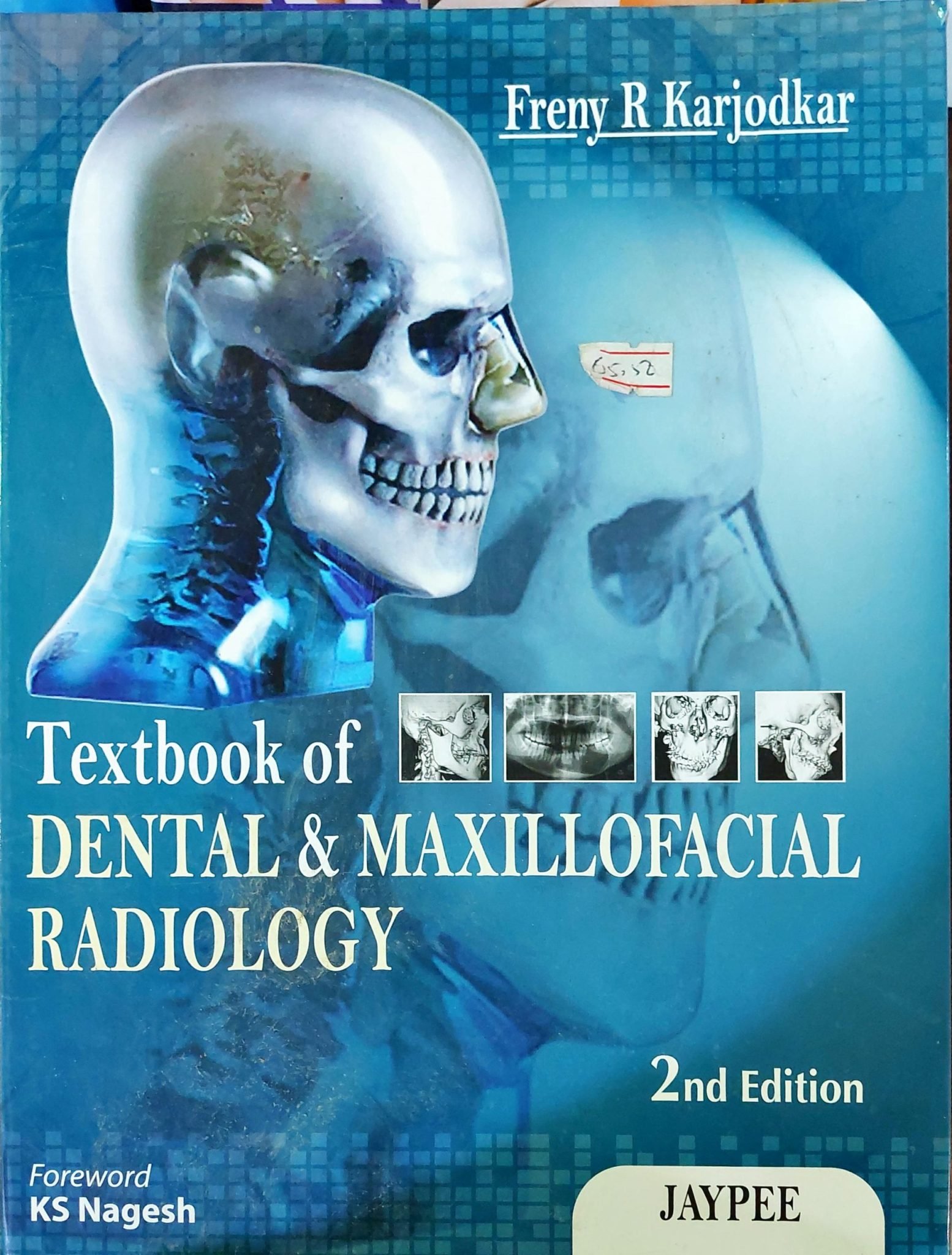 Textbook Of Dental And Maxillofacial Radiology | Nesraf
